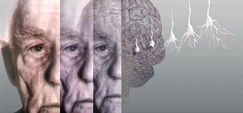 Expert highlights natural aging process and impact on sensory organs